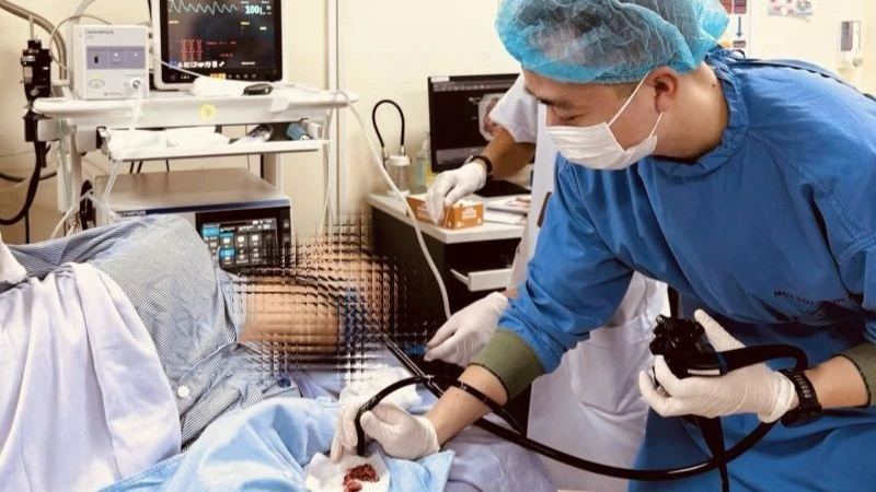 The application of flexible endoscopy techniques successfully removed a ...