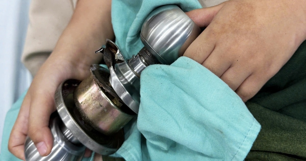 Emergency services rescued 5-year-old boy whose finger was stuck in a ...