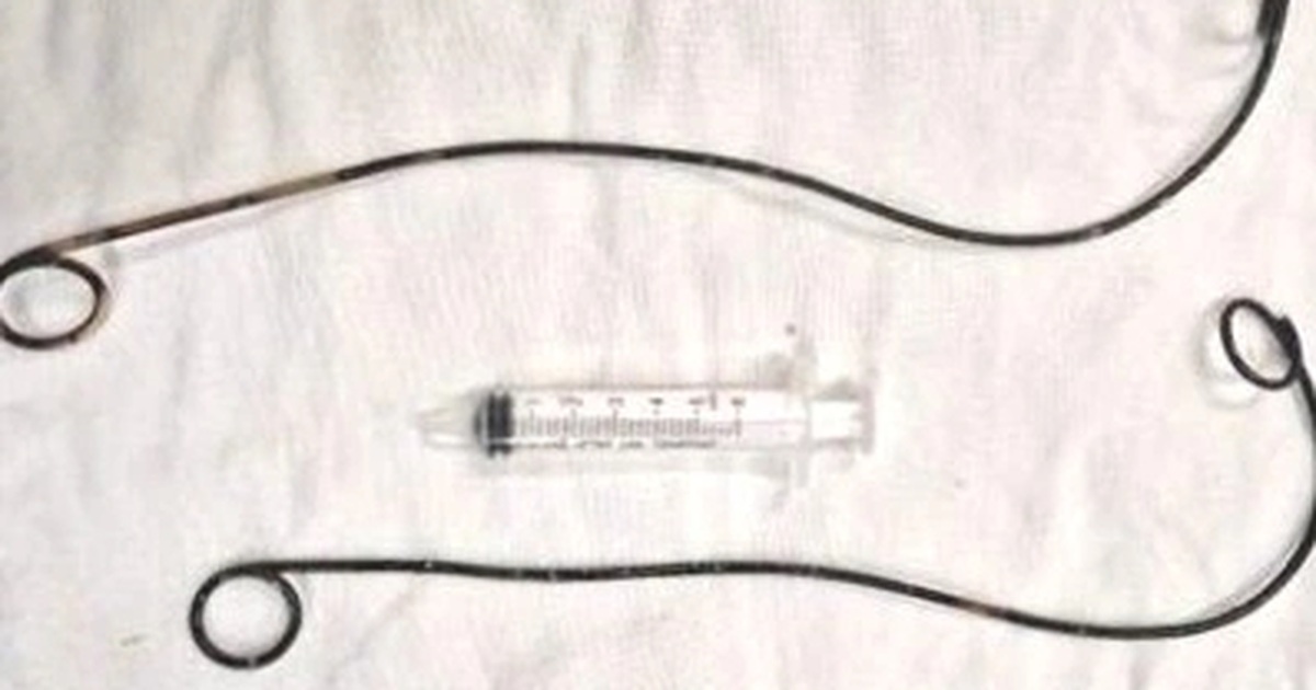Authorities retrieved two urinary catheters left inside a man's body ...