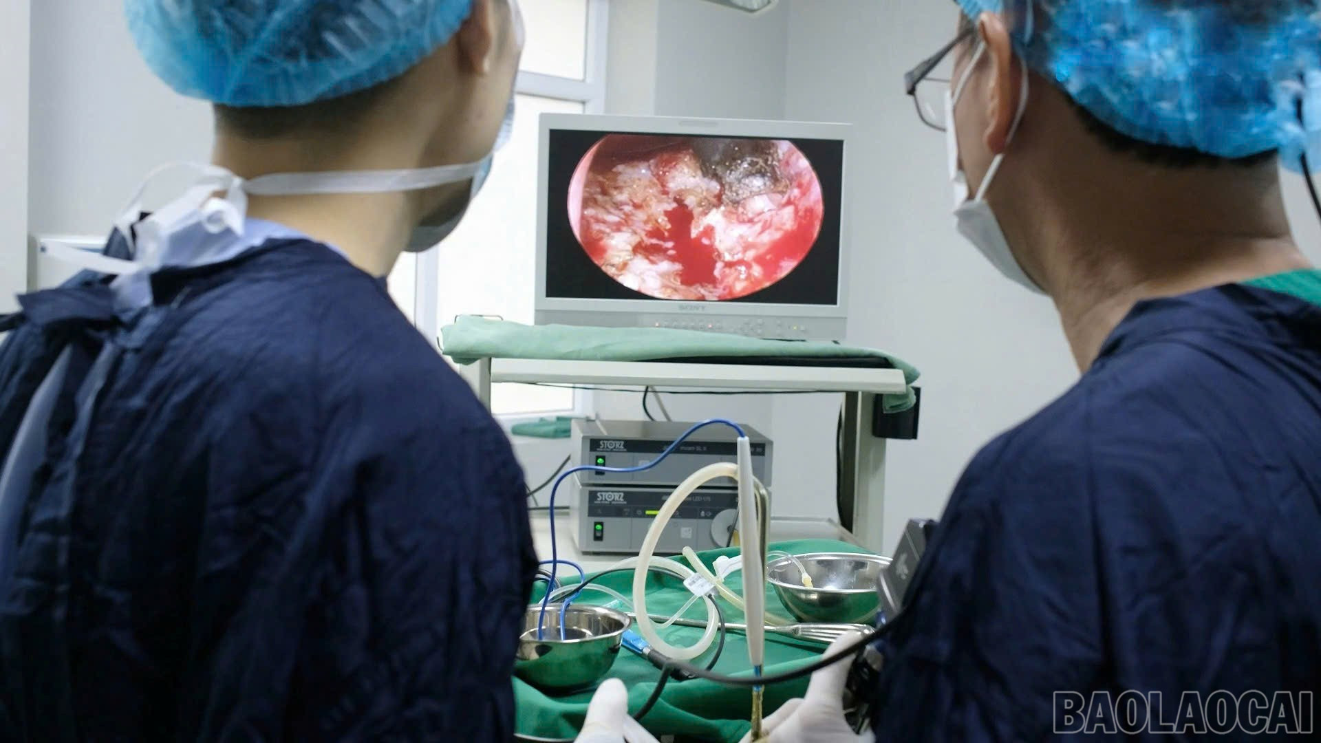 Implementing the technique of adenoidectomy using a plasma scalpel.