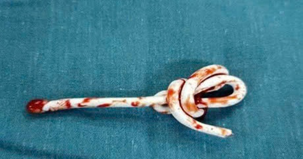 Boy hospitalized after string inserted into urethra, following online ...
