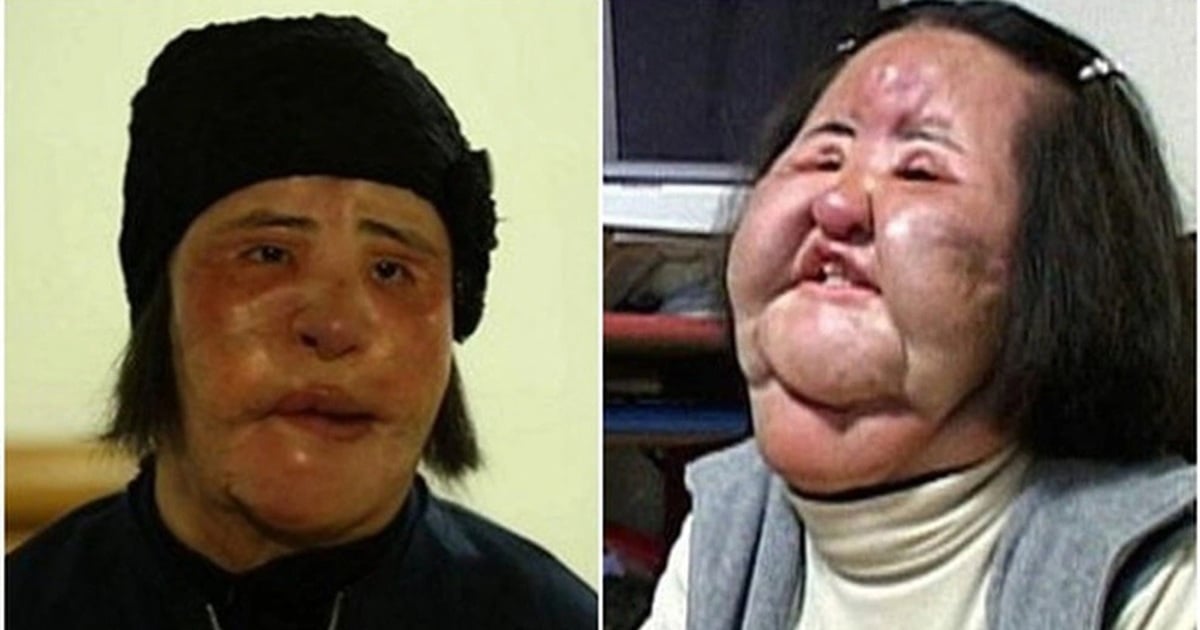 The tragedy of a Korean beauty icon whose life was ruined by plastic ...