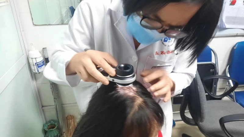 Kapan kerontokan rambut dianggap sebagai kondisi medis yang membutuhkan ...