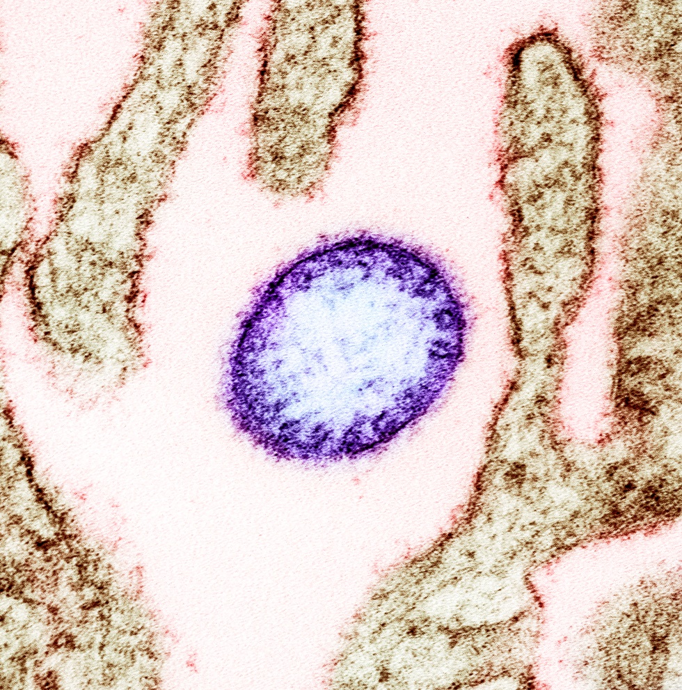 Things you need to know about the deadly Nipah virus.