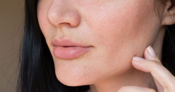 Itchy, uncomfortable facial skin: be wary of fungal infection.