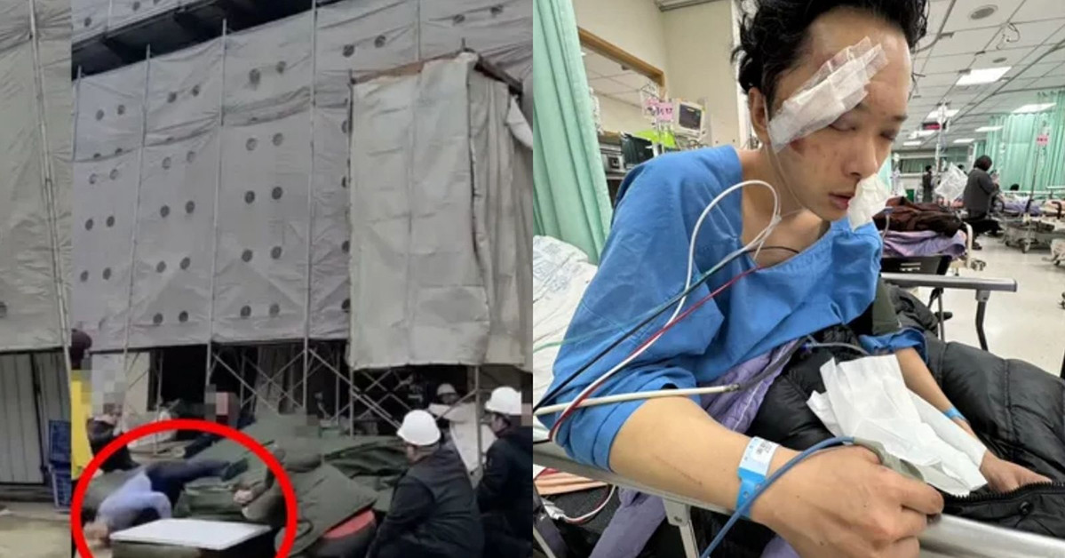 Actor To Duc Duong suffered facial fractures and is in a coma due to an ...