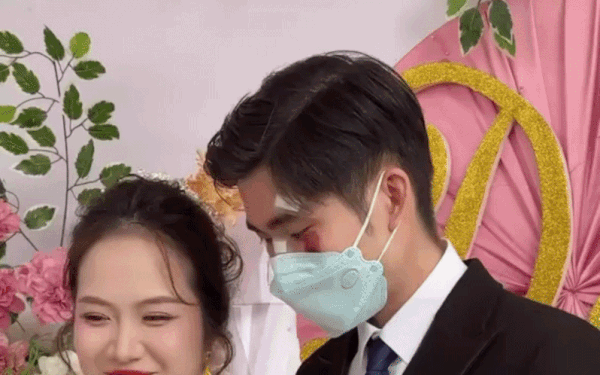Chú rể đeo khẩu trang che mặt đầy vết thương trong ngày cưới
