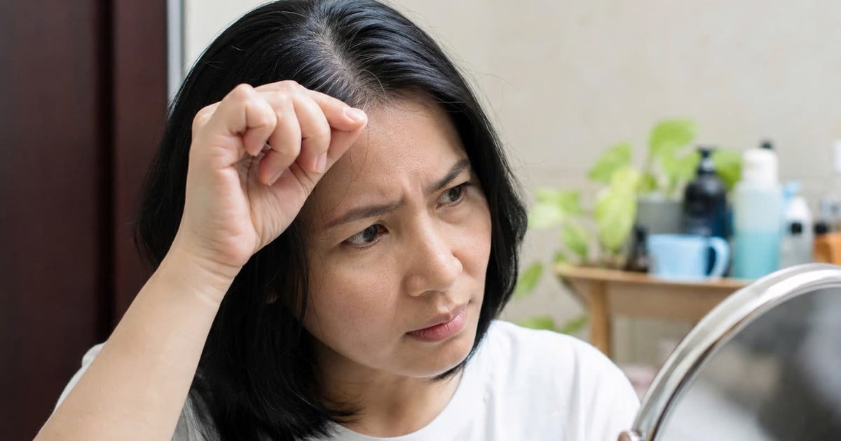 Nhổ tóc bạc có khiến tóc bạc nhiều hơn? Chuyên gia giải đáp