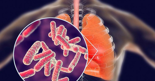 What is the incubation period for pneumonia?